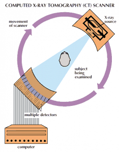 CT_Scanner_Diagram.jpg | FarLabs